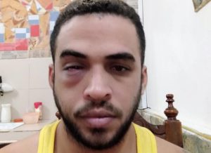 Periodista Héctor Luis Valdés Cocho necesita con urgencia medicinas ...