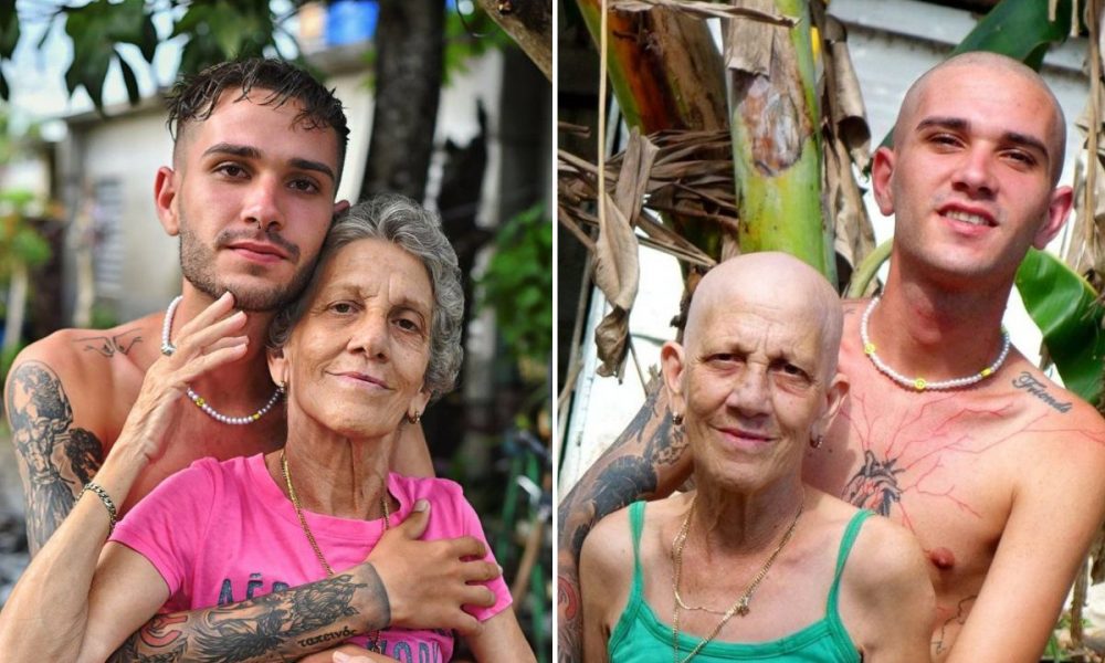 Mastectomía con conservación de pezón esperanza para pacientes con ...