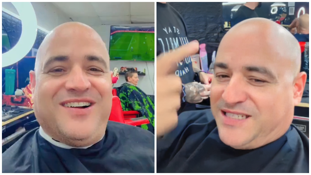 Andy Vázquez dice adiós a la calvicie ¡Así luce el humorista cubano ahora!