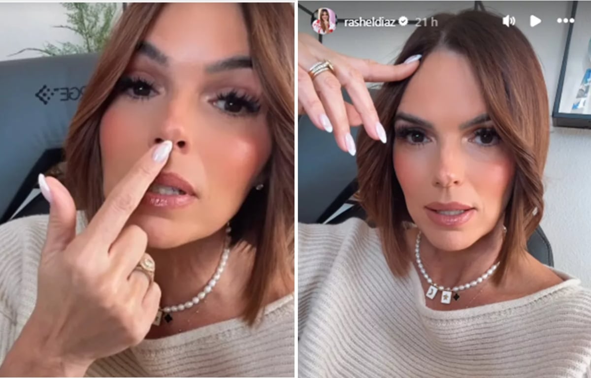 ¿Rashel Díaz se operó la nariz y no quedó bien?