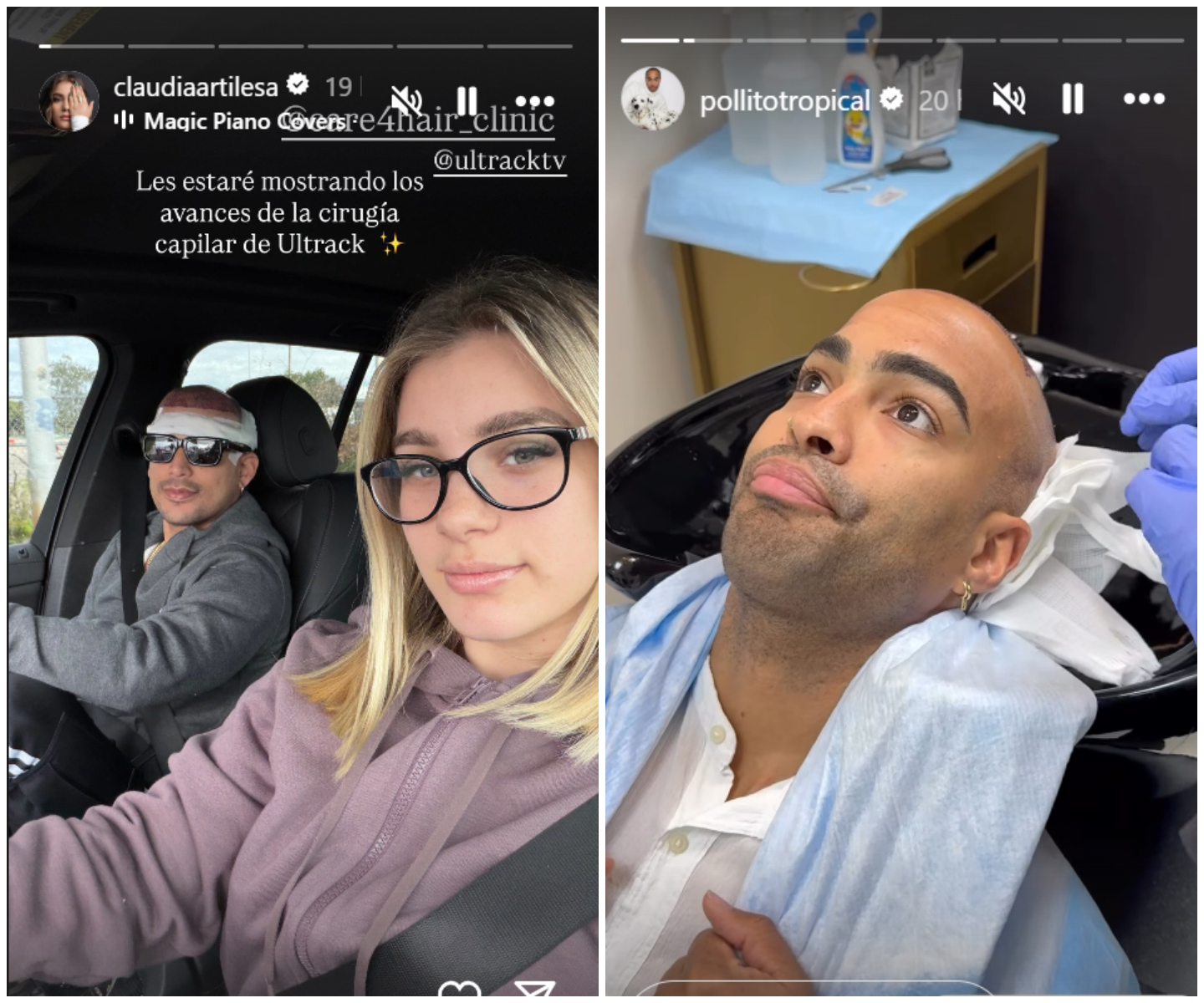 Ultrack se somete a un trasplante capilar en Miami al igual que Pollito ...