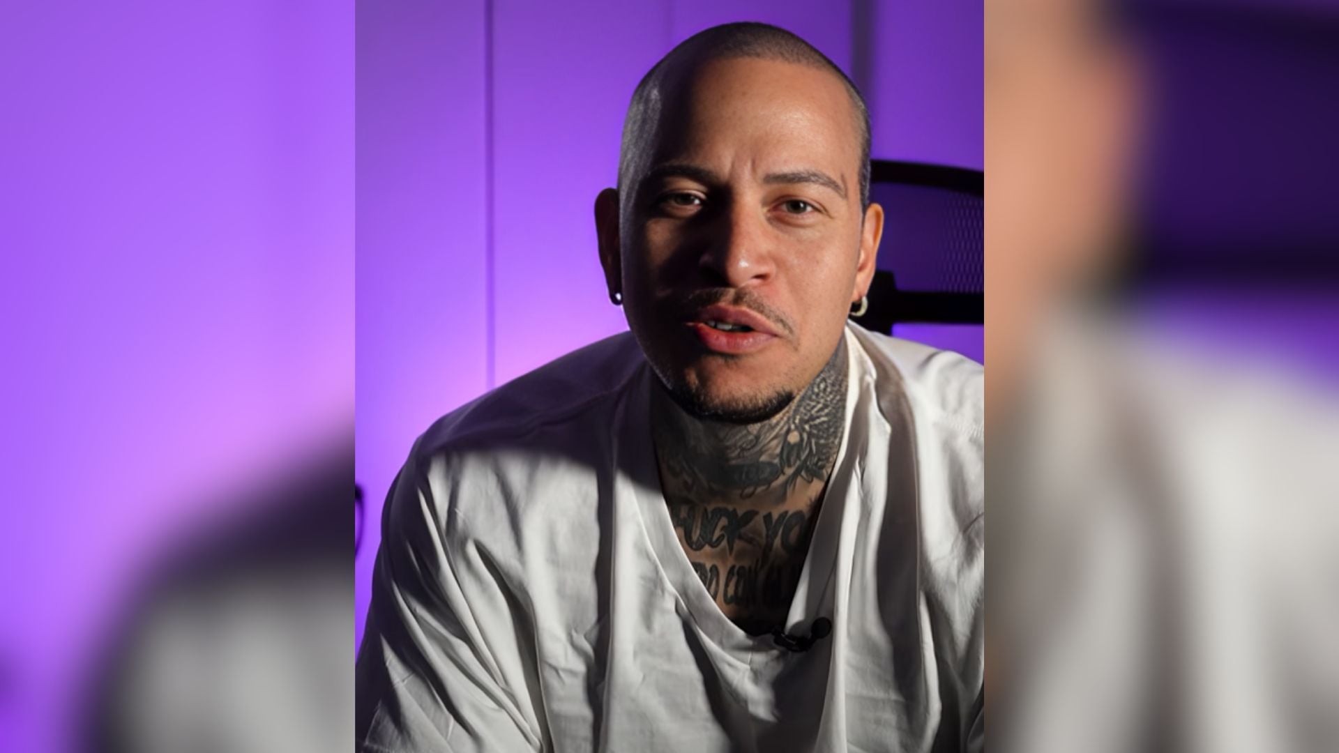 El Chulo se realiza una cirugía de transplante capilar en Miami